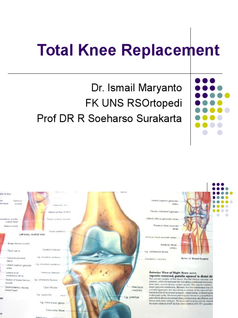 An Overview of Total Knee Replacement Including Indications, Surgical ...