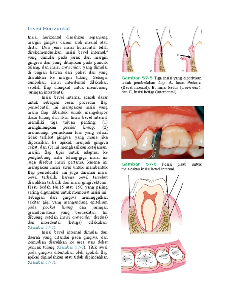 Insisi Horizontal | PDF