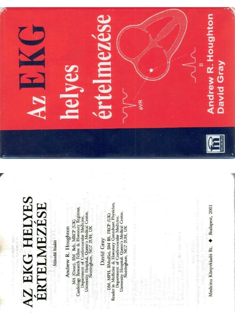 Az EKG Helyes Értelmezése PDF | PDF