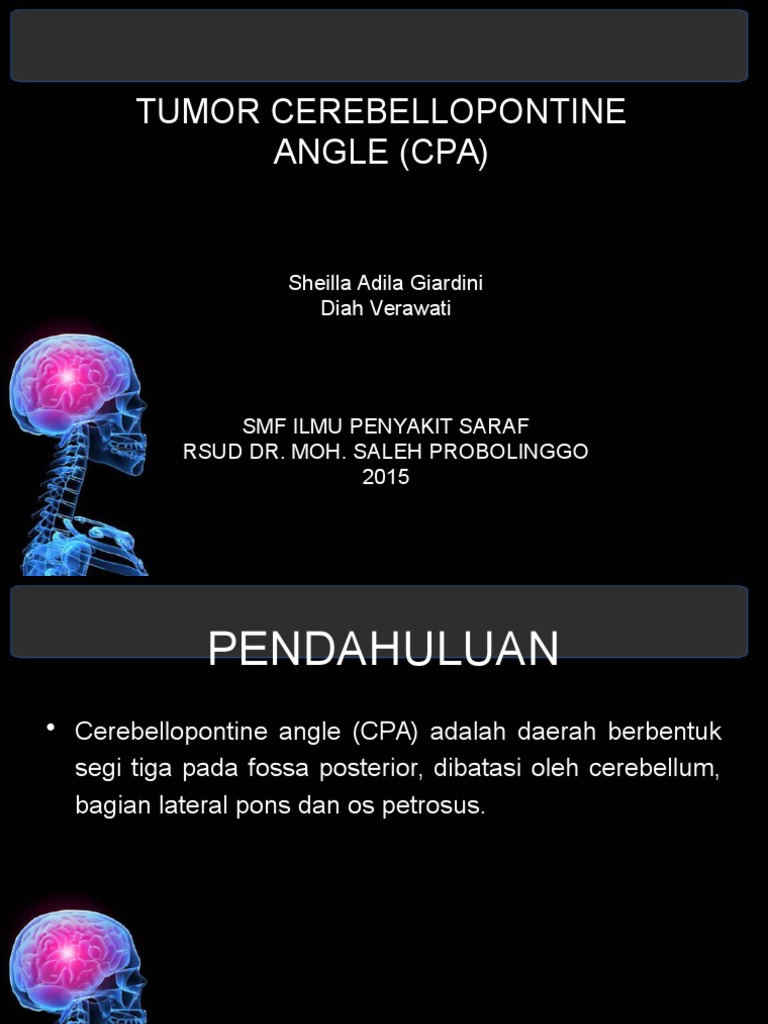Cerebellopontine Angle (CPA) Tumor | PDF