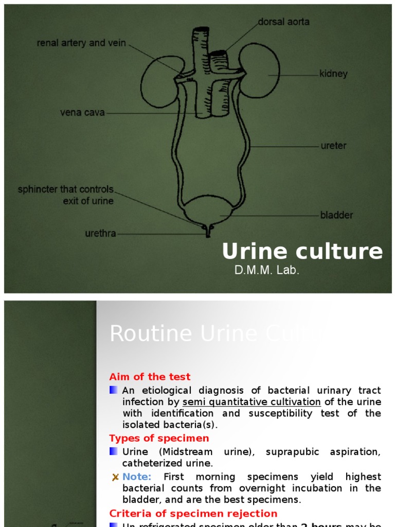 Urine Culture | Colony Forming Unit | White Blood Cell