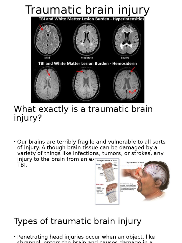 Traumatic Brain Injury | PDF | Traumatic Brain Injury | Individualized ...