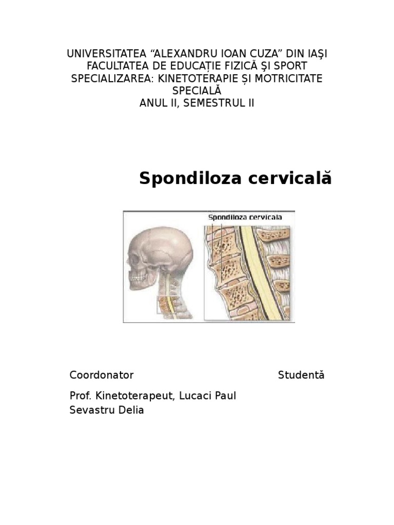 Spondiloza cervicala