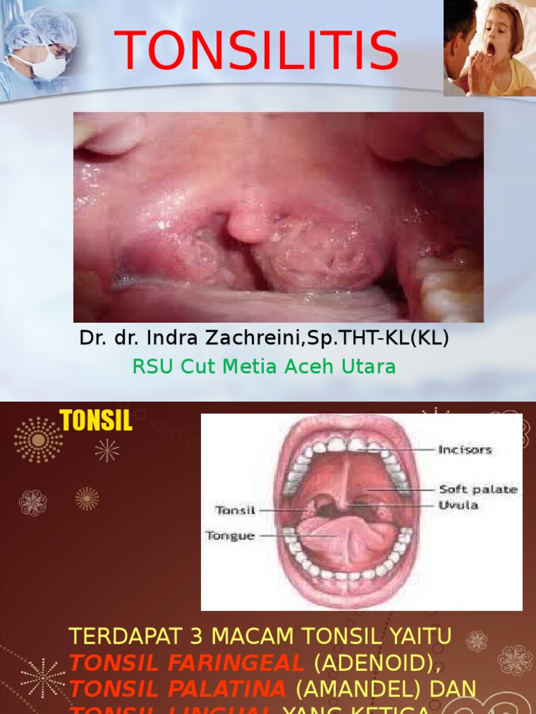 Tonsilitis | PDF | Kesehatan Holistik
