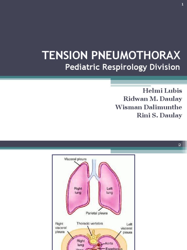 Understanding Tension Pneumothorax | PDF | Lung | Pulmonology