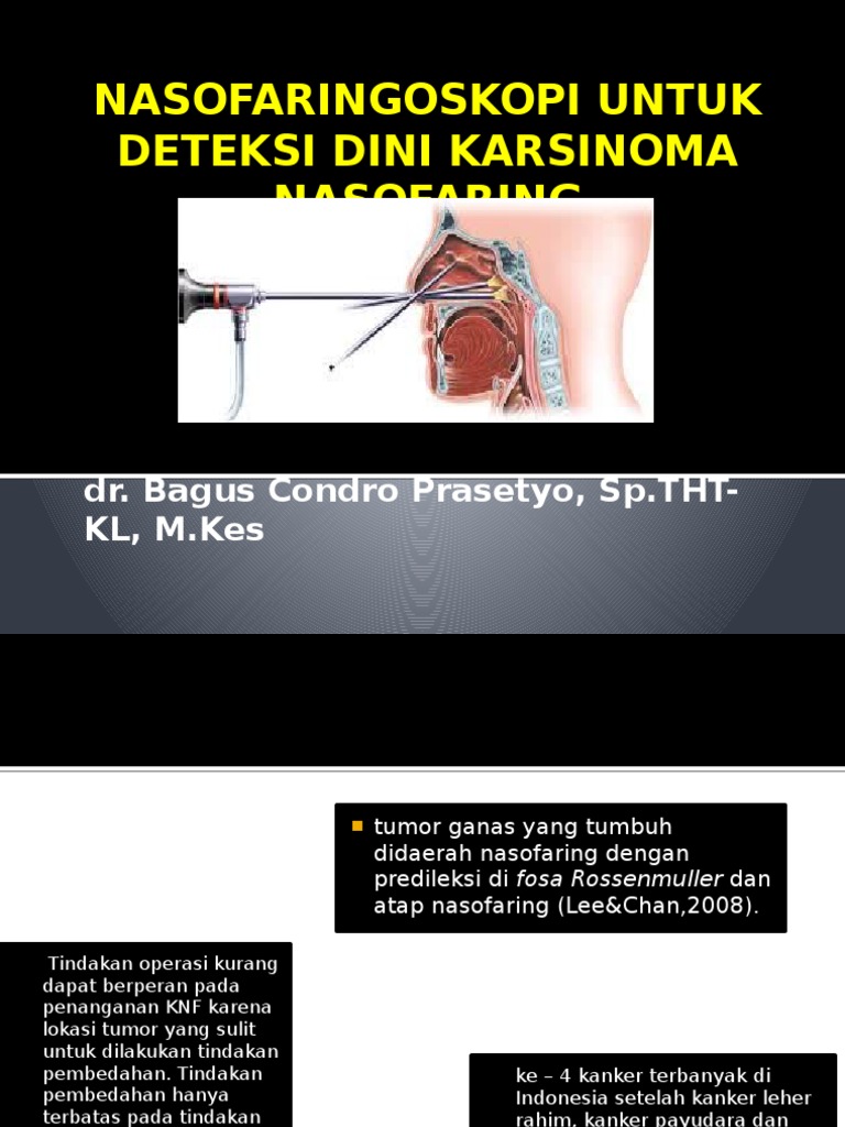 Deteksi Dini Karsinoma Nasofaring | PDF | Pengembangan Diri