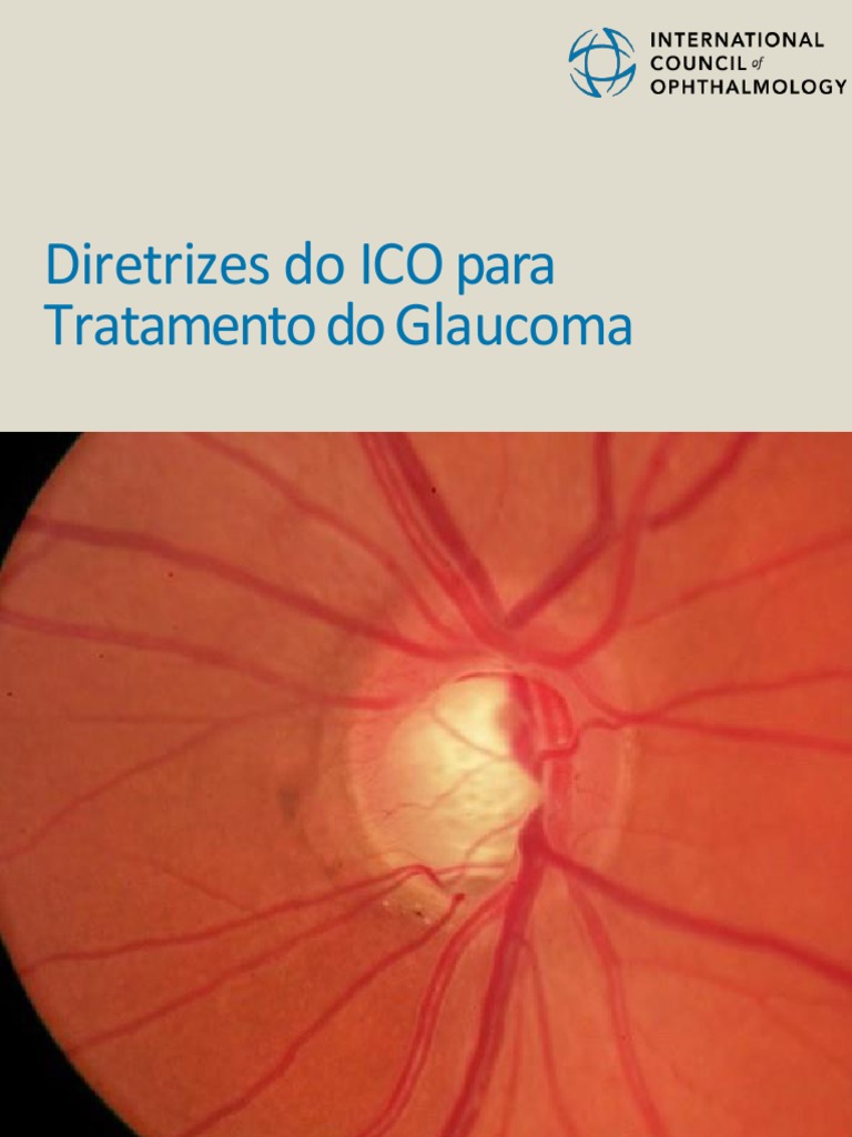 Diretrizes ICO para Tratamento do Glaucoma | PDF | Sistema visual ...