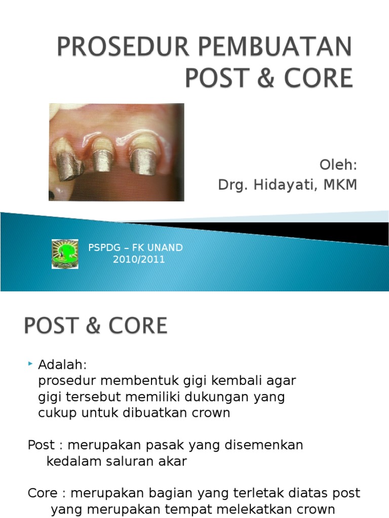 Prosedur Post-Core Gigi dan Crown | PDF