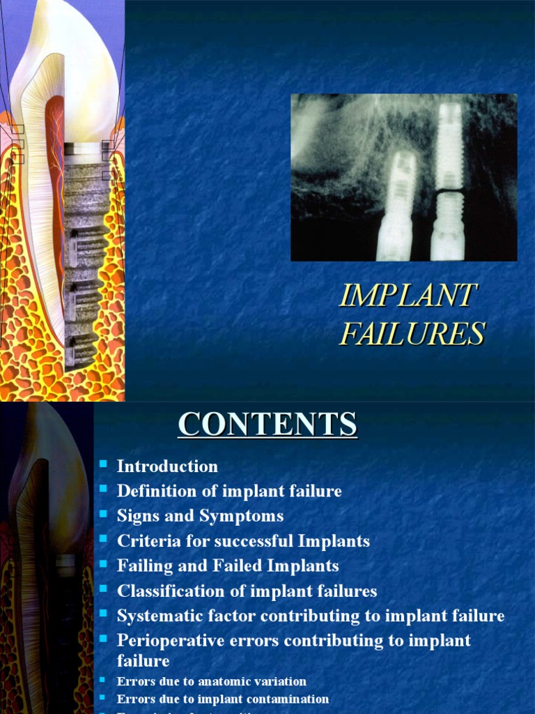 Implant Failures | PDF | Dental Implant | Torque