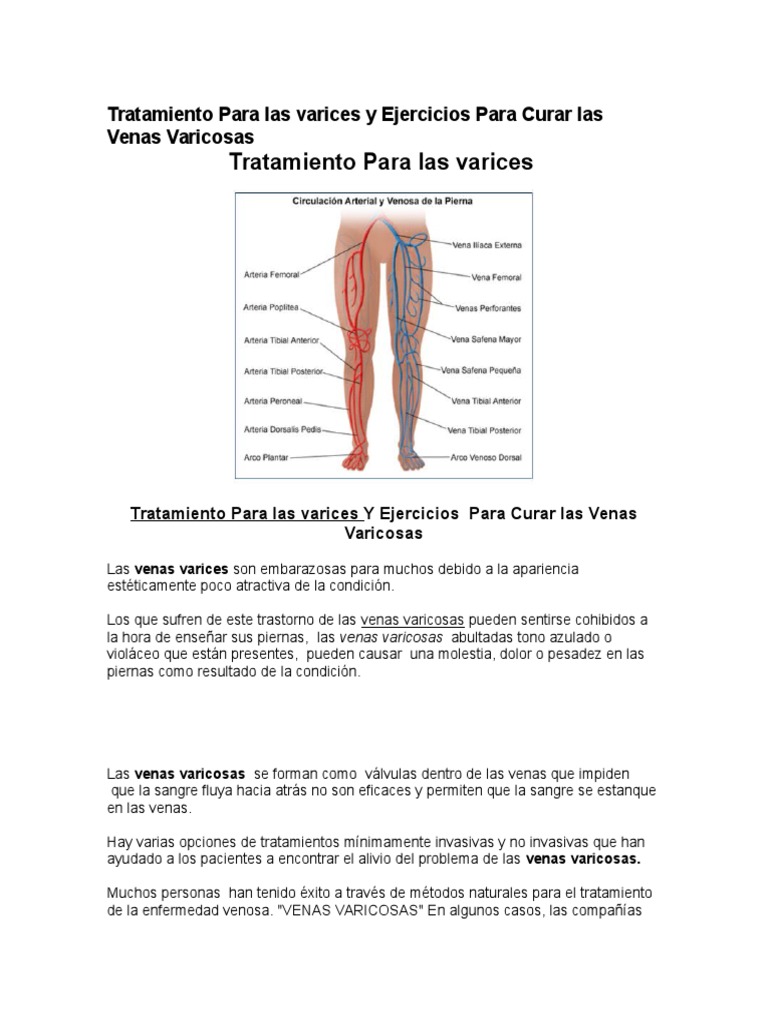 Tratamiento Para Las Varices y Ejercicios Para Curar Las Venas ...