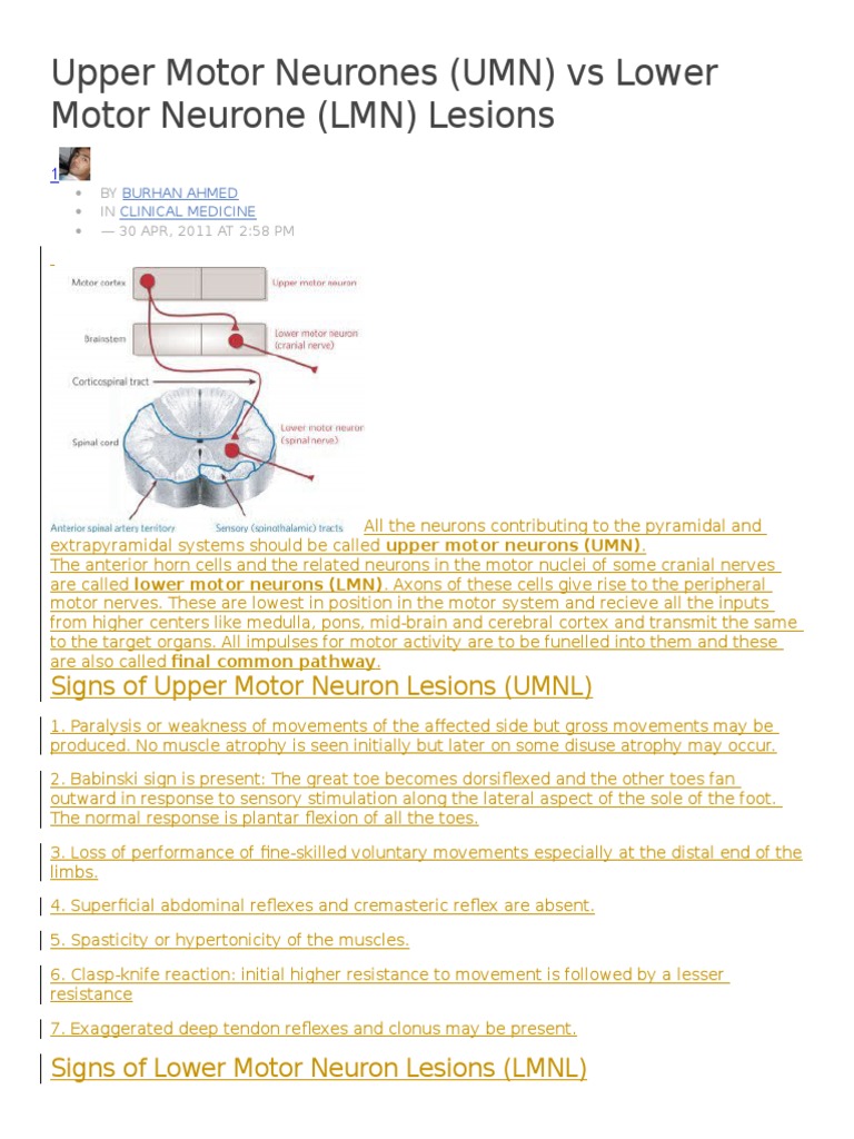 UMN vs LMN Including Mnemonic | Motor Neuron | Muscle