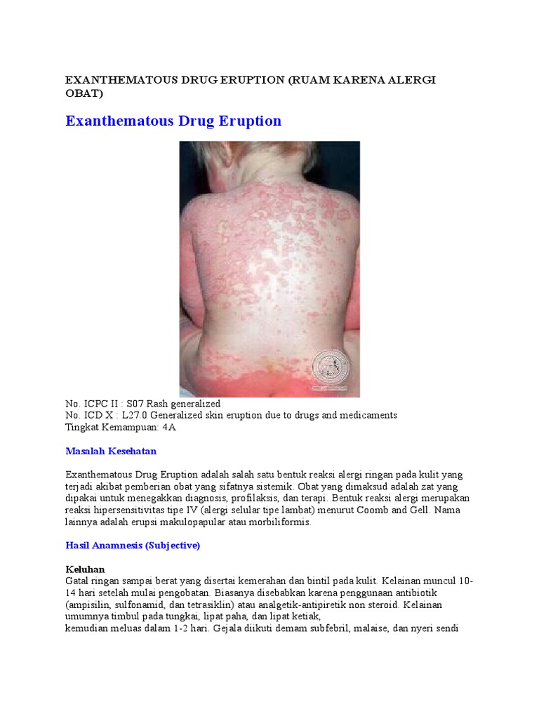 Exanthematous Drug Eruption | PDF | Pengembangan Diri
