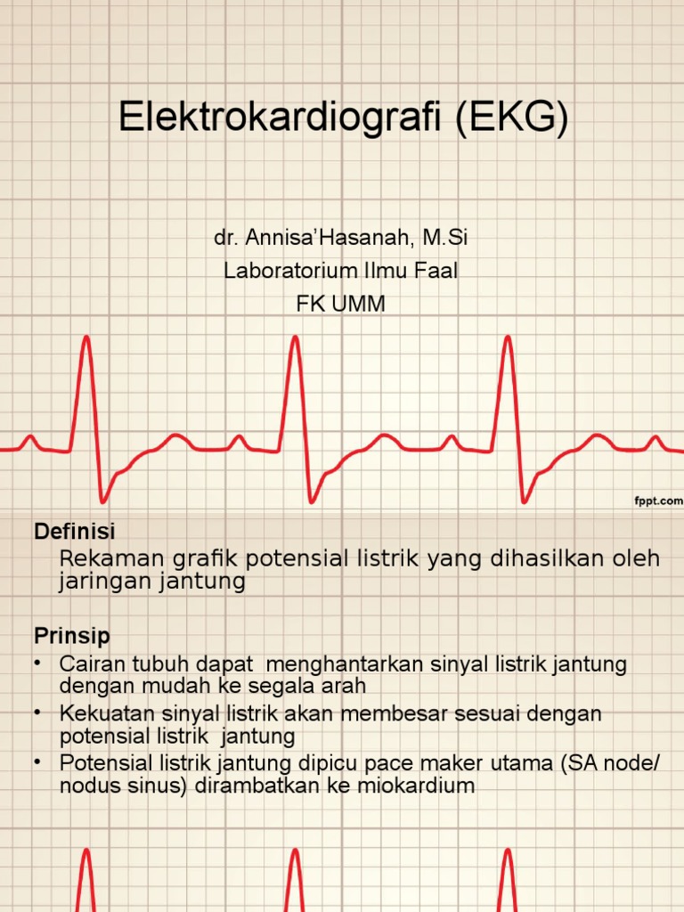 Ekg | PDF