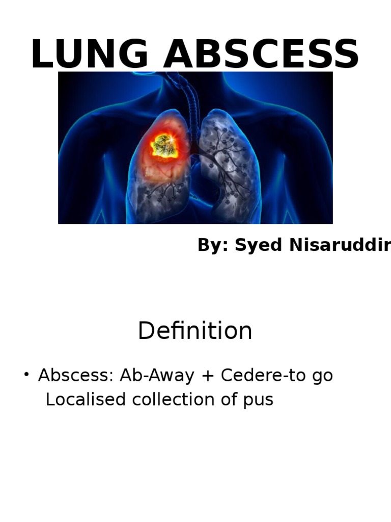 Understanding Lung Abscesses | PDF | Science & Mathematics