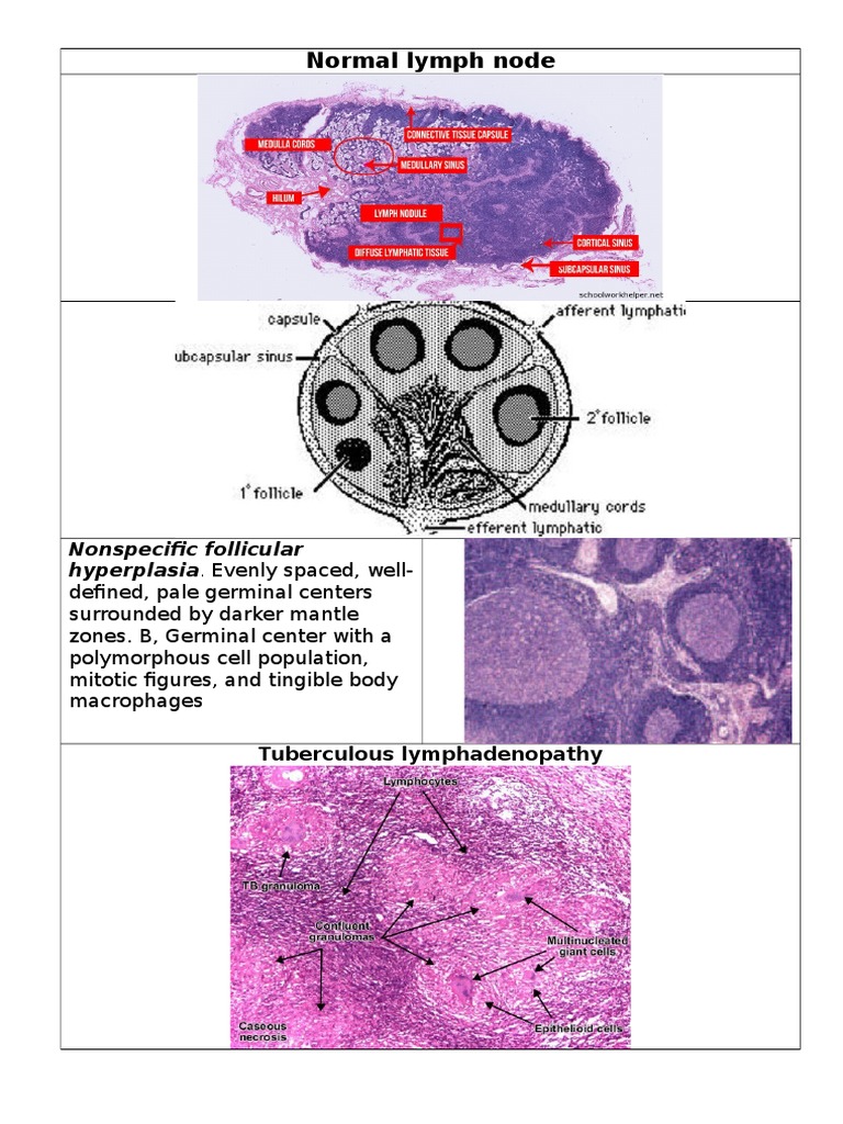 Normal Lymph Node | PDF