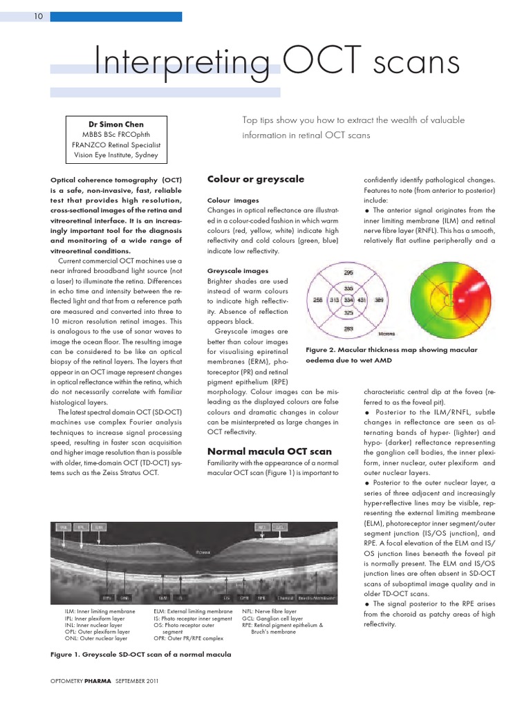 Interpreting OCT Scans Chen | Download Free PDF | Retina | Senses
