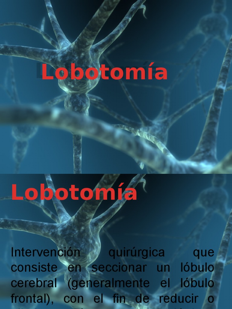 Lobotomía | PDF | Relaciones personales, crianza y desarrollo personal ...