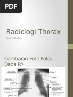 Anatomi Thorax Normal pada Rontgen | PDF