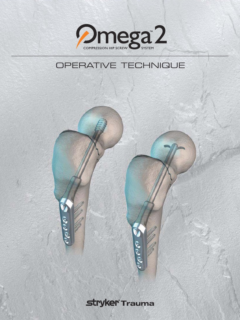 Omega2 Standard PDF | PDF