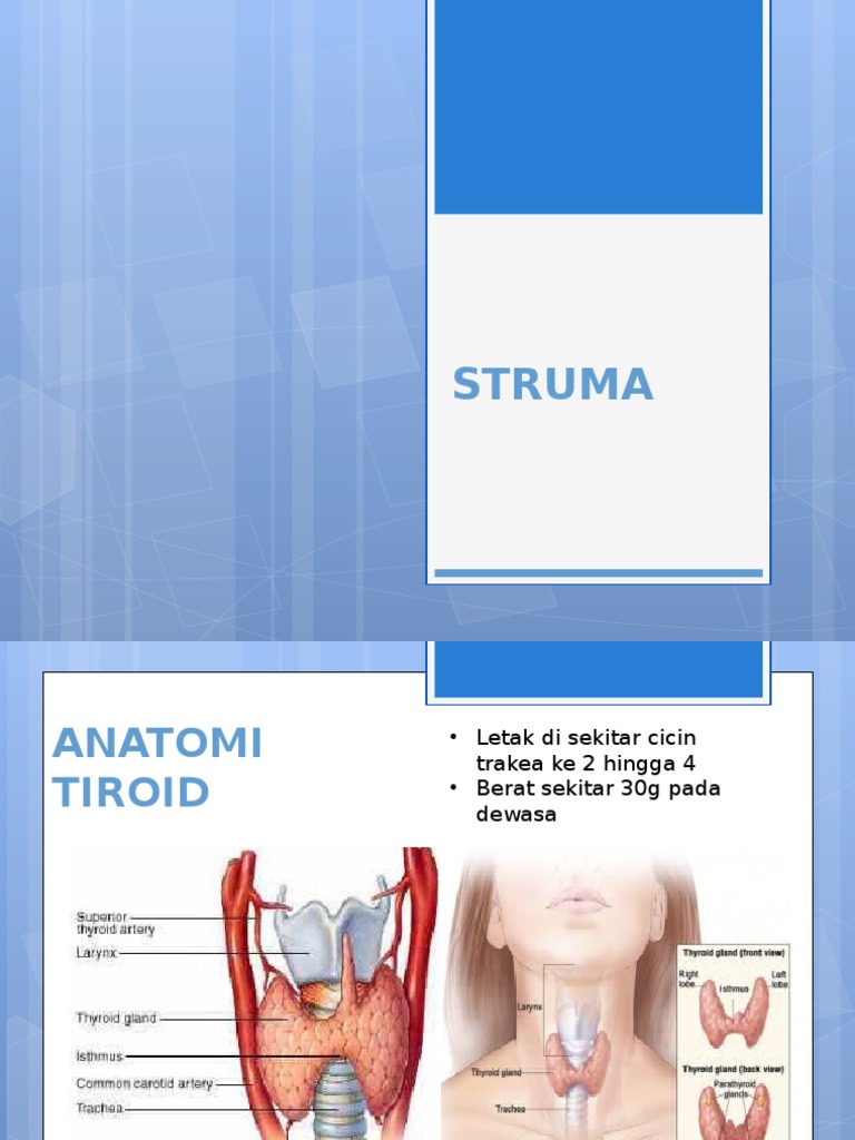 Struma & Keganasan Pada Tiroid | PDF | Sains & Matematika