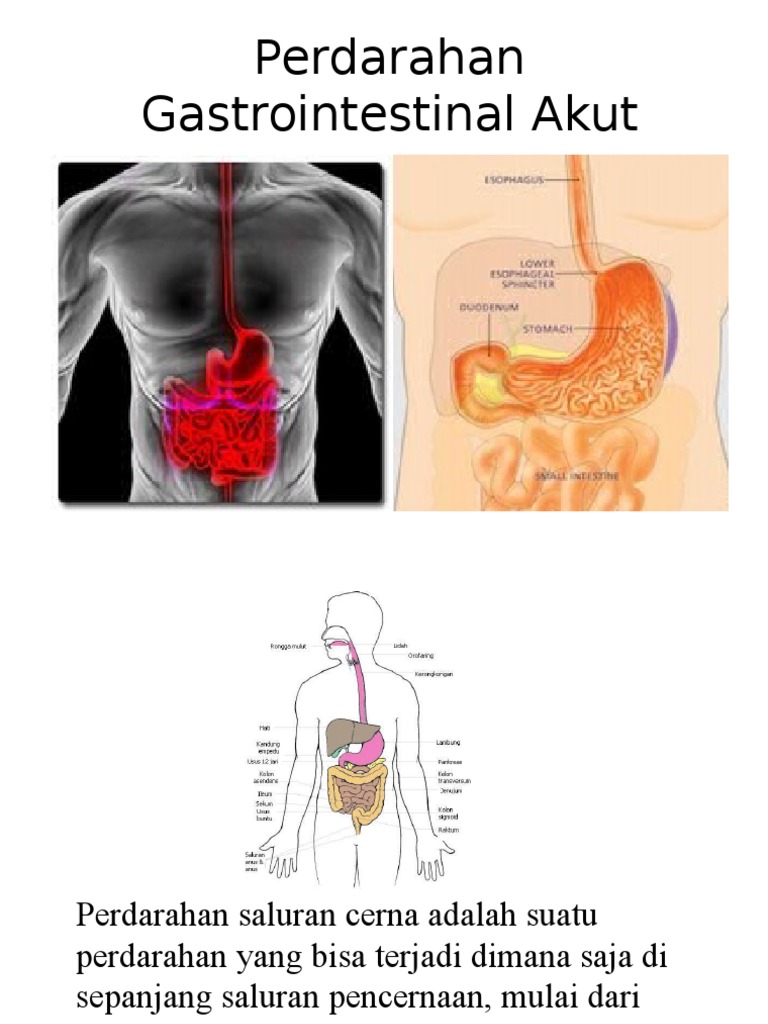 Perdarahan Gastrointestinal Akut | PDF