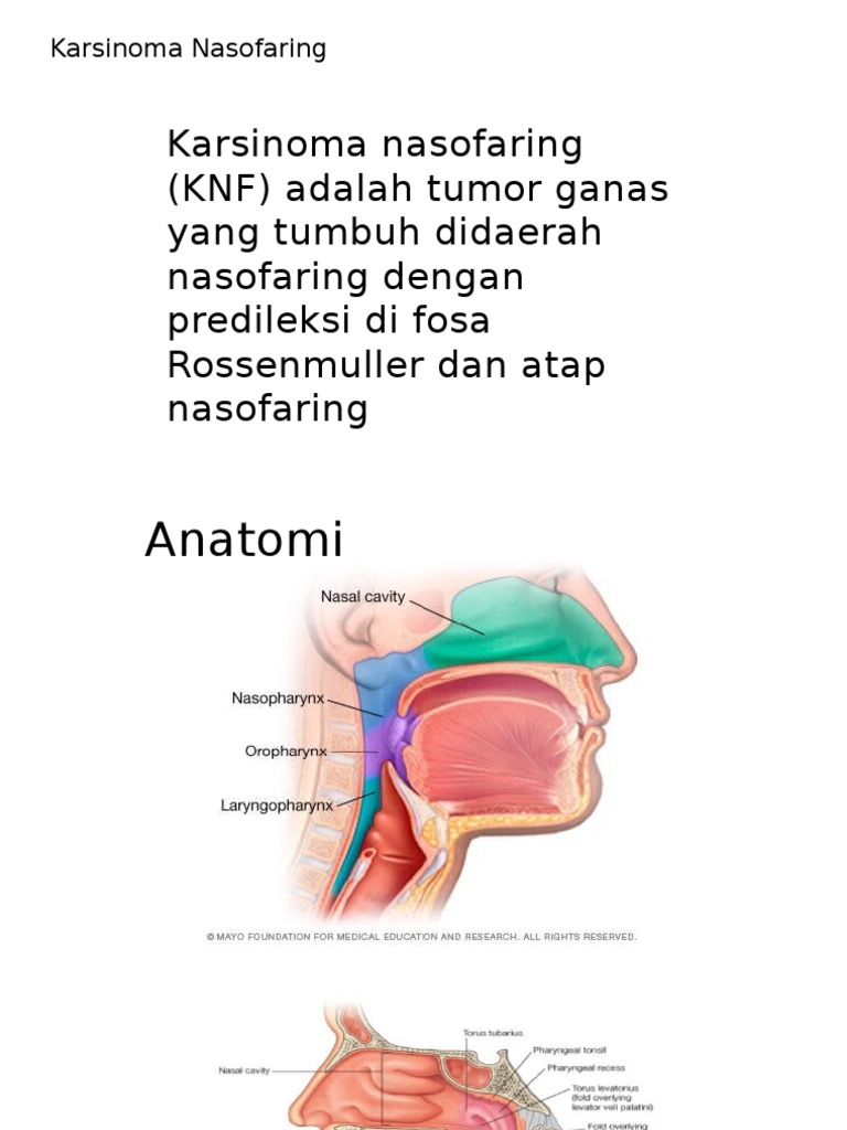 Karsinoma Nasofaring | PDF