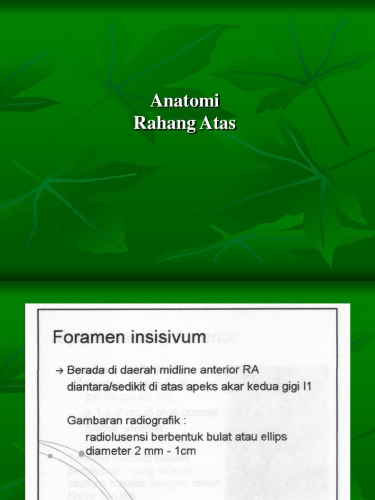 Anatomi Maksila PDF | PDF