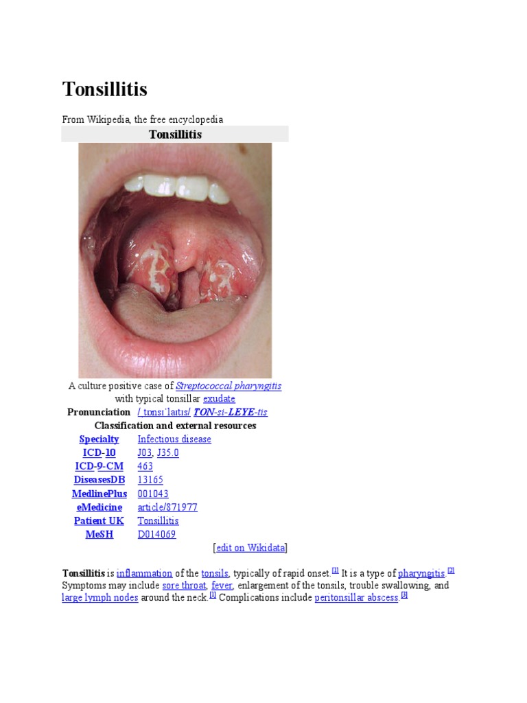 Tonsillitis | PDF | Respiratory Diseases | Epidemiology