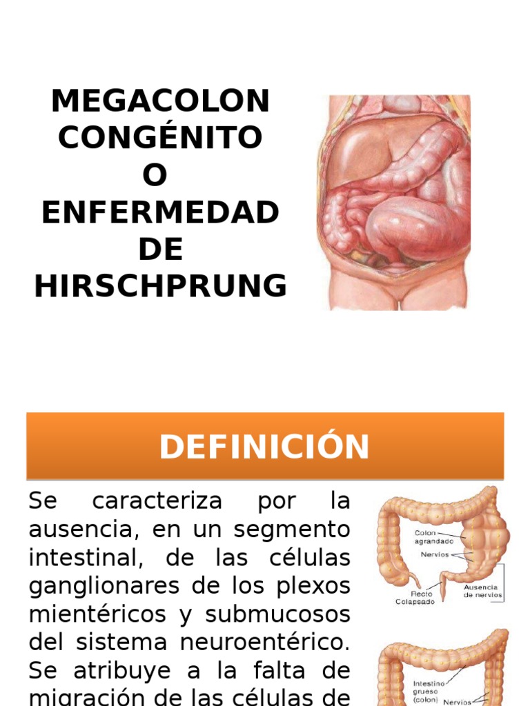 MEGACOLON CONGÉNITO | Enfermedades y trastornos | Medicina clínica
