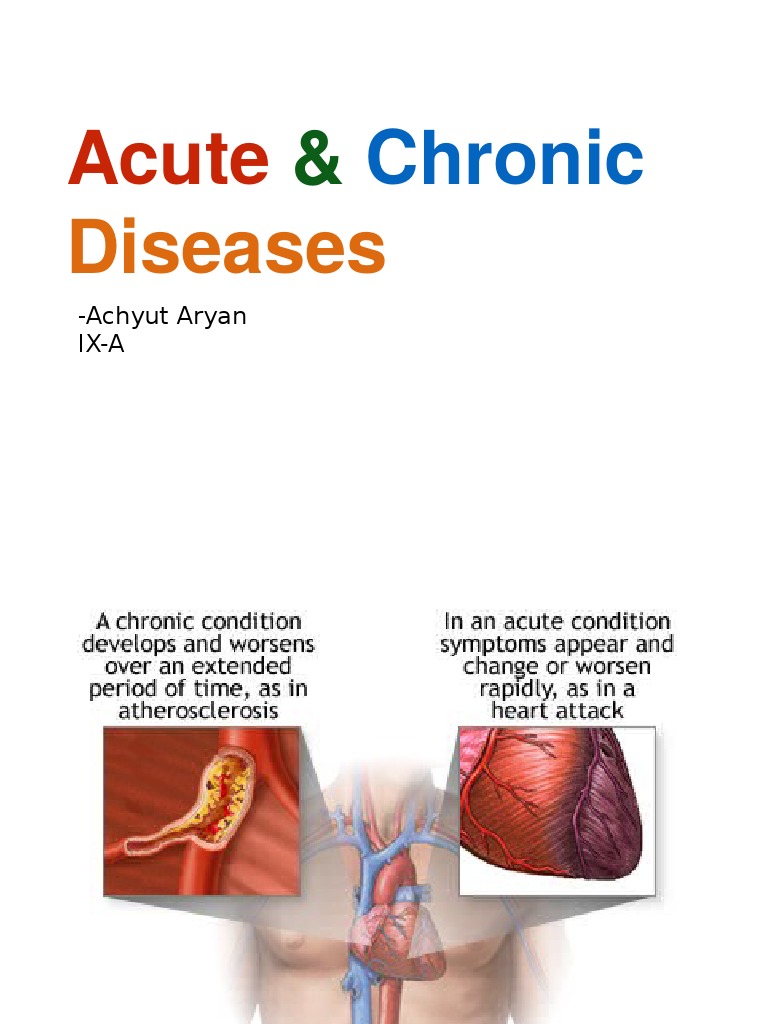 Acute and Chronic Diseases | PDF | Chronic Condition | Rtt