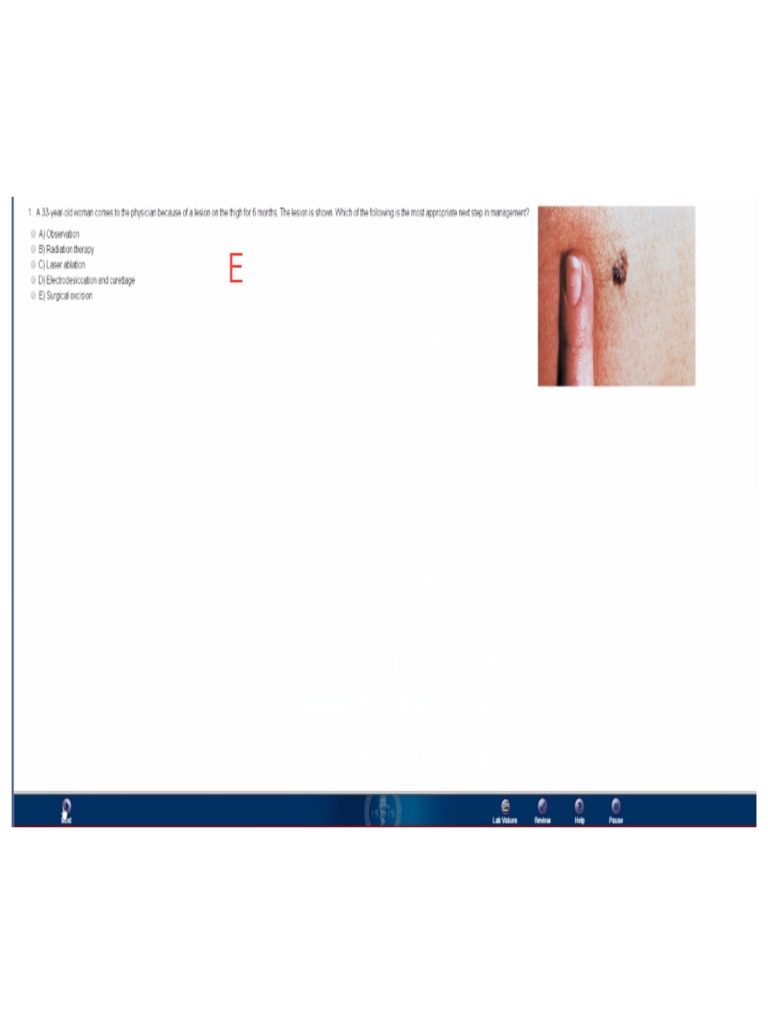 Internal Medicine NBME 3 | PDF | Epidemiology | Medicine