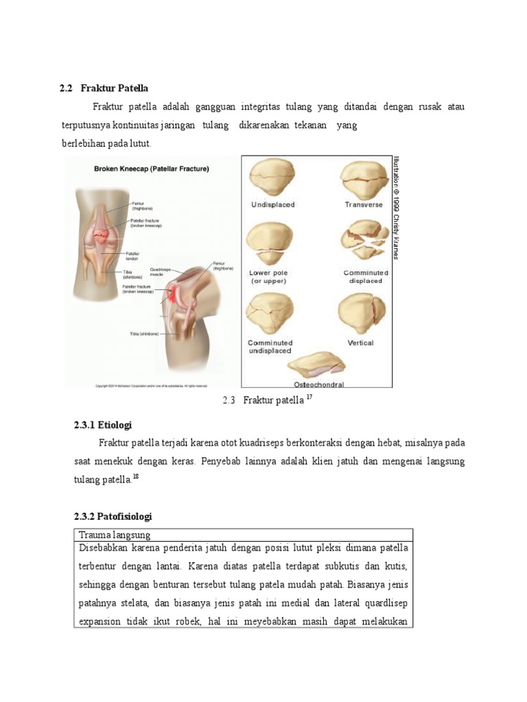 Fraktur Patella | PDF