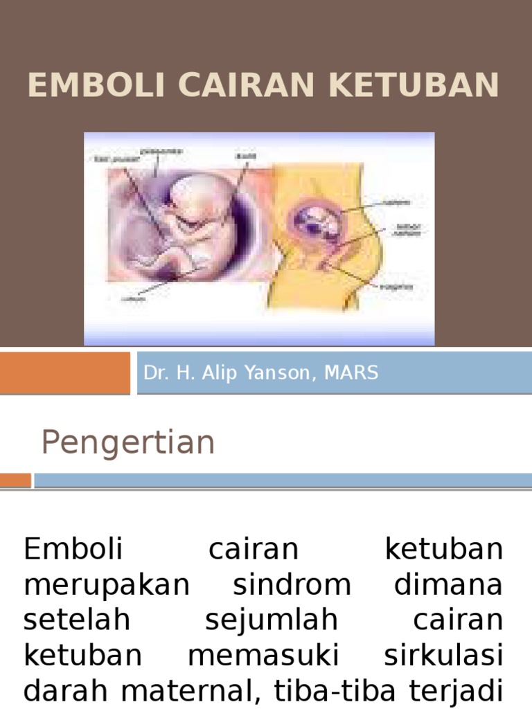 Emboli Cairan Ketuban | PDF