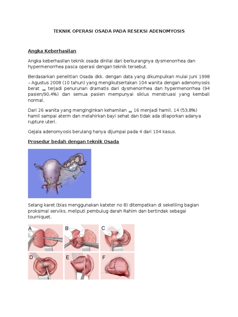 Tugas Osada Teknik | PDF