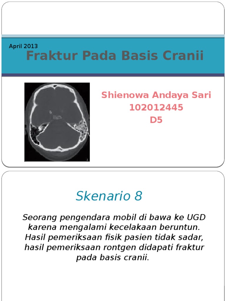Fraktur Pada Basis Cranii | PDF