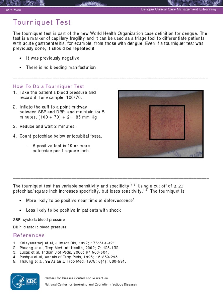 Tourniquet Test F | PDF