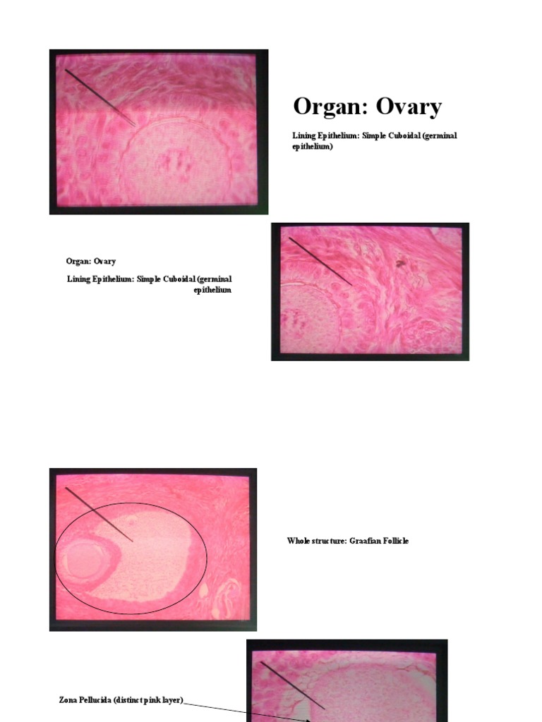 Organ: Ovary: Lining Epithelium: Simple Cuboidal (Germinal Epithelium ...