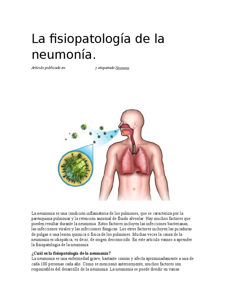 La Fisiopatología de La Neumonía | PDF | Neumonía | Epidemiología
