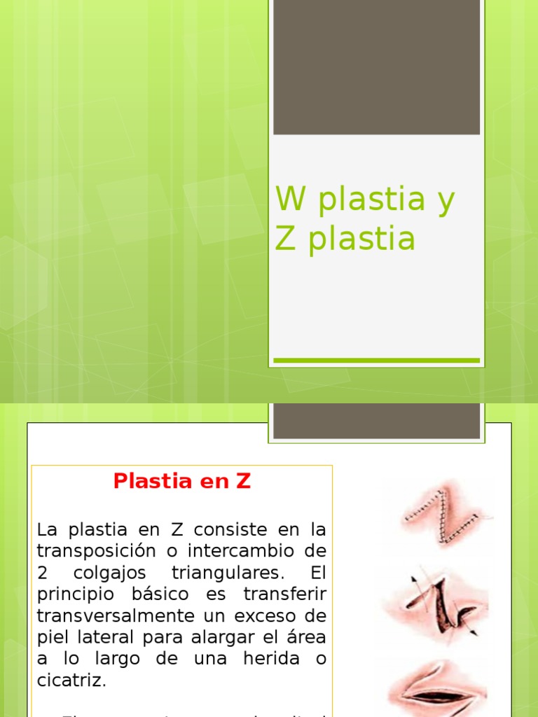 Técnicas de plastia en Z y W | PDF
