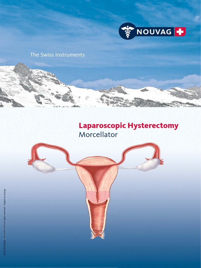 Katalog Morcellator PDF | PDF