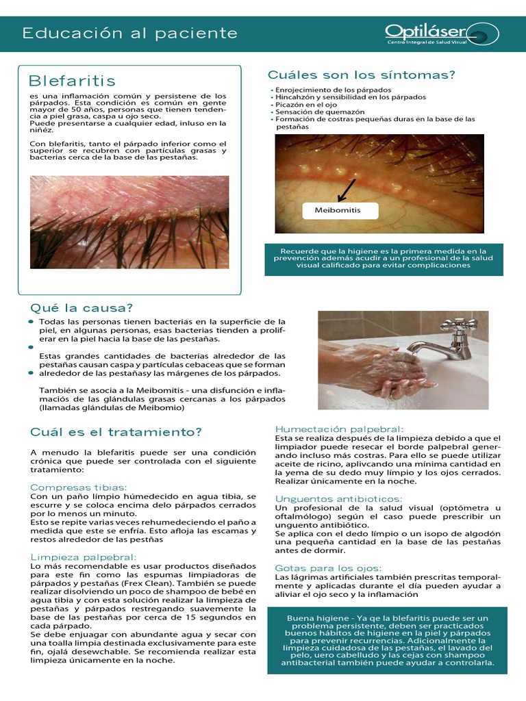 Blefaritis Definicion y tratamiento | Especialidades Medicas ...