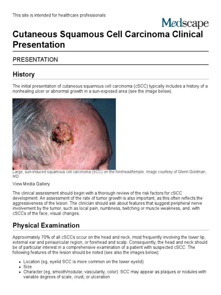 Cutaneous Squamous Cell Carcinoma Clinical Presentation - History ...