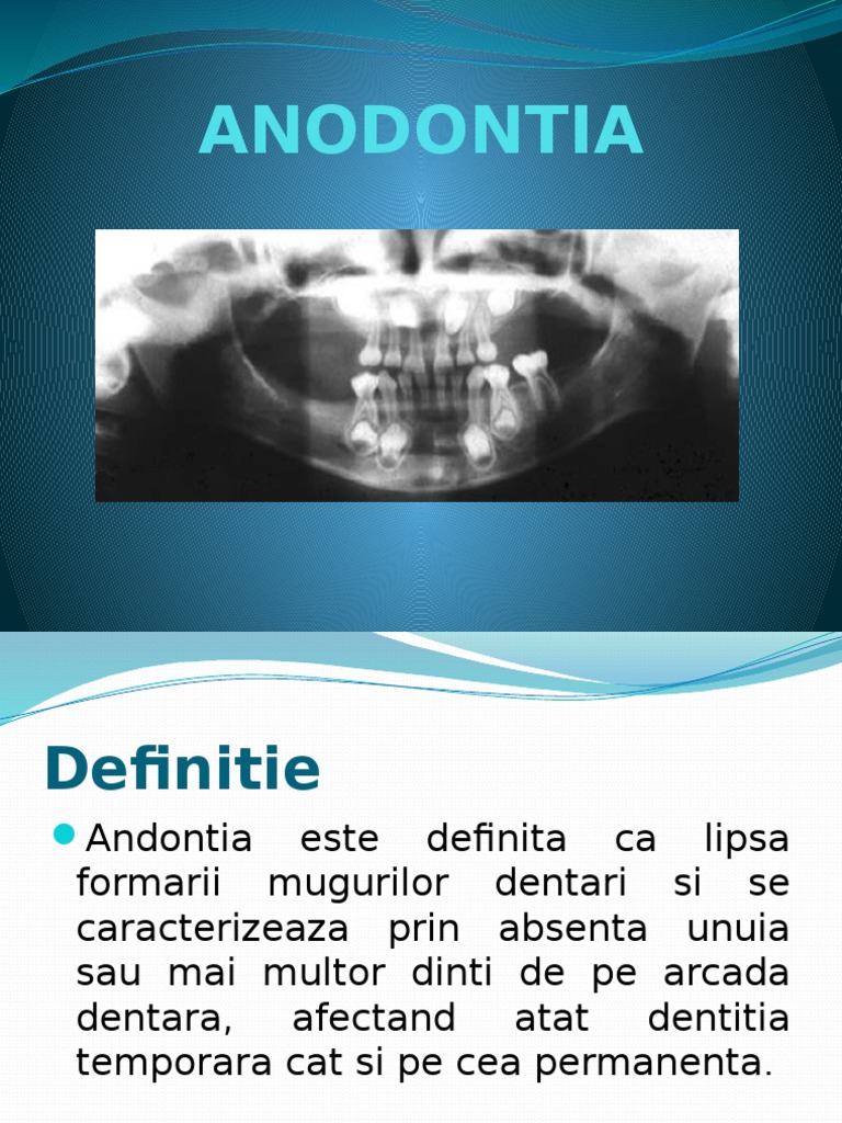 ANODONTIA-Final (1).pptx