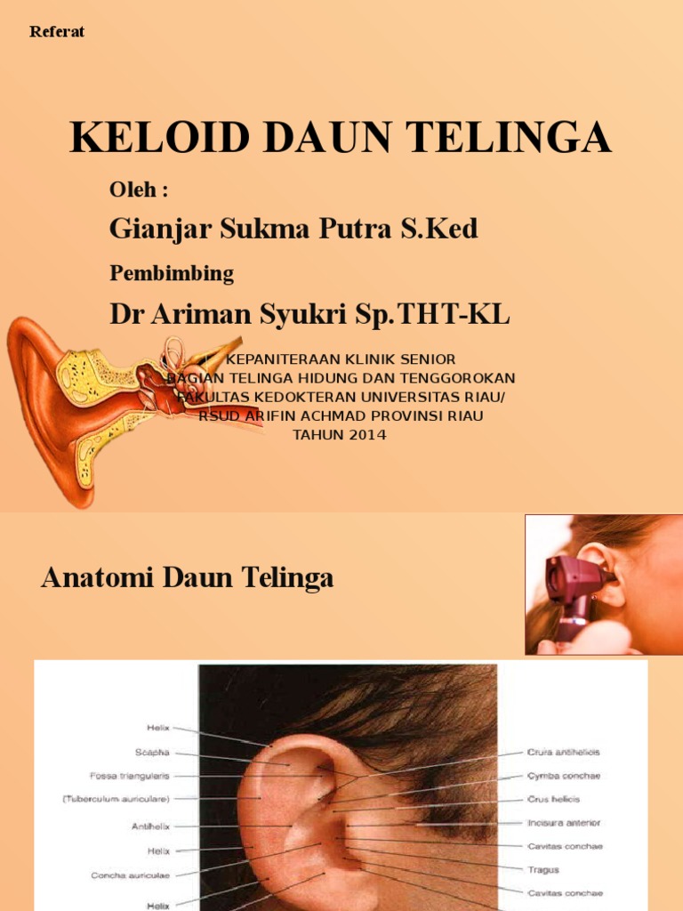 Keloid Daun Telinga | PDF