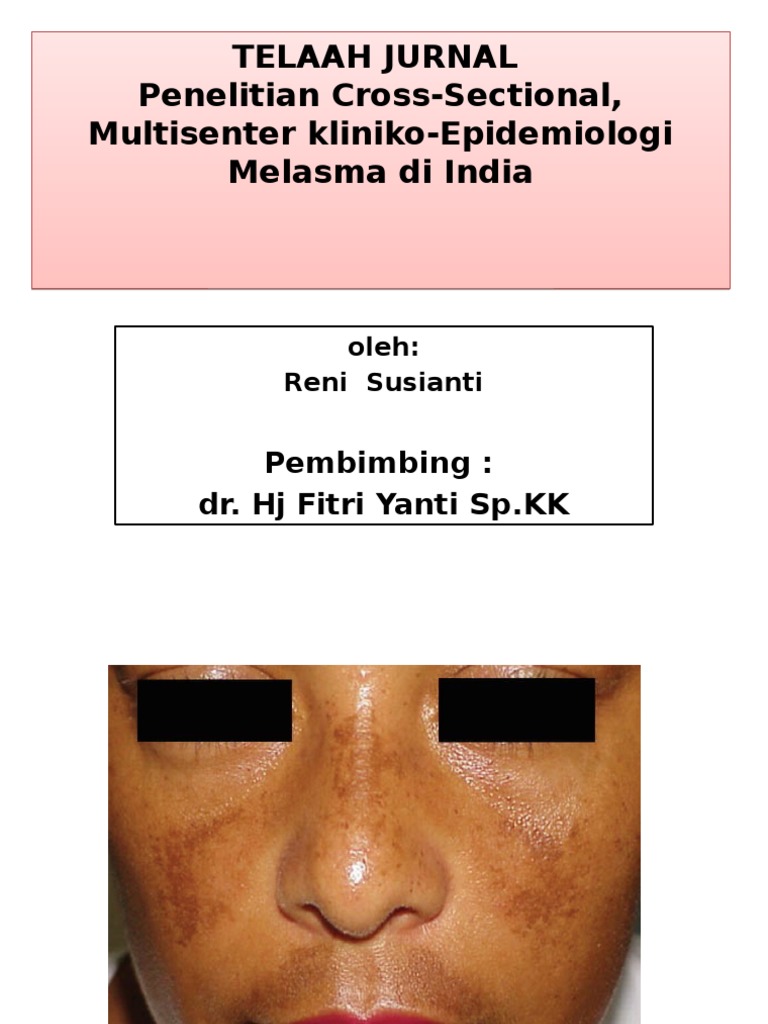 Epidemiologi Melasma di India | PDF | Pengembangan Diri | Kesehatan ...