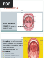 Tonsilofaringitis Akut | PDF | Kesehatan Holistik | Sains & Matematika
