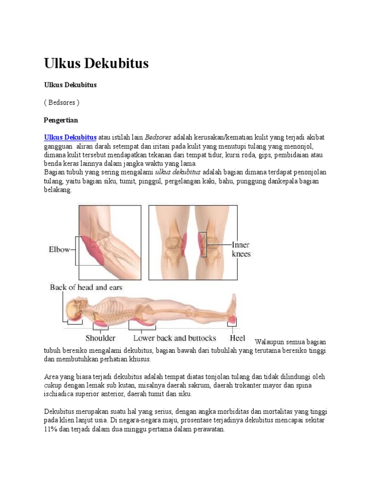 Ulkus Dekubitus | PDF