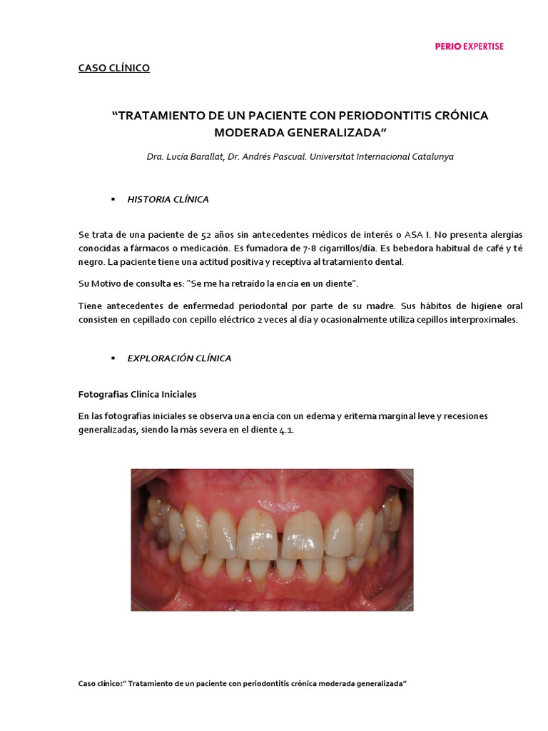 Tratamiento de Un Paciente Con Periodontitis Crónica Moderada ...