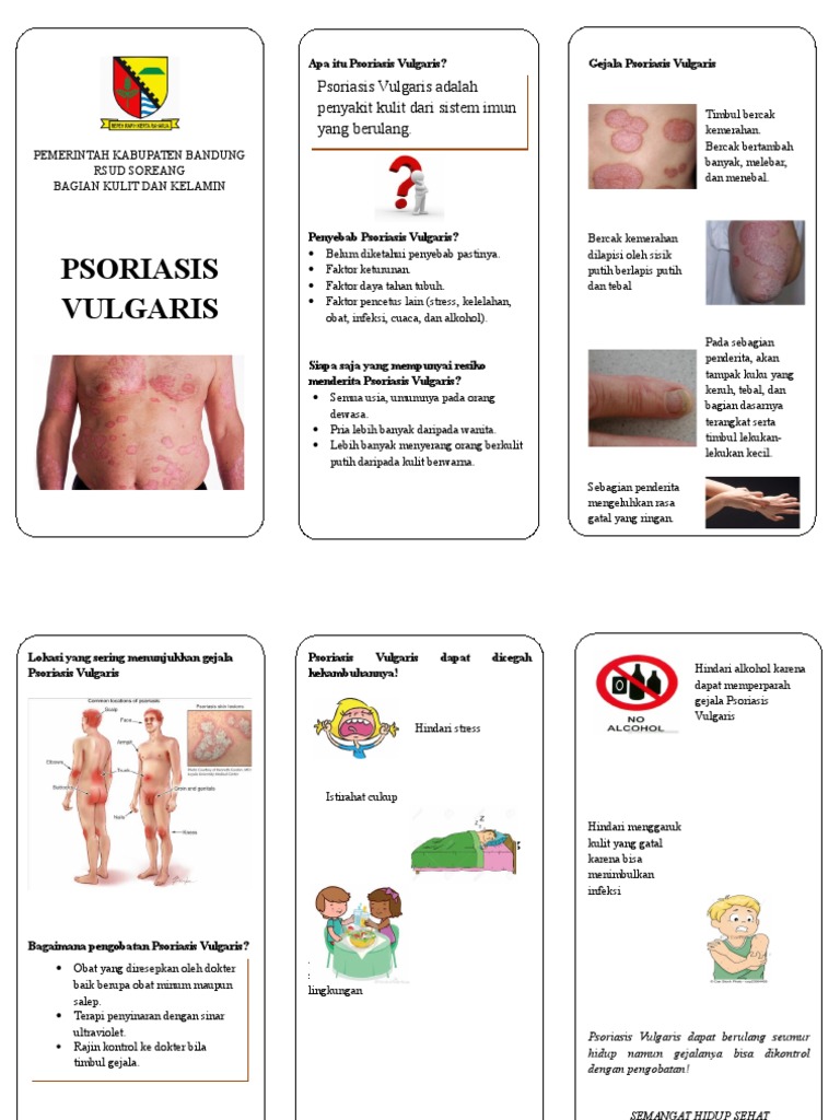 Psoriasis Vulgaris Leaflet | PDF