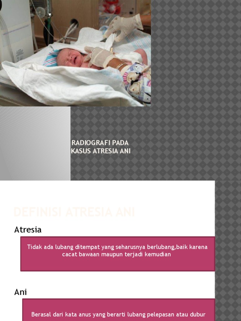 Atresia Ani | PDF